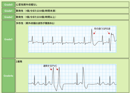 心電図の基礎から実践までをわかりやすく！ | ヘルスノート
