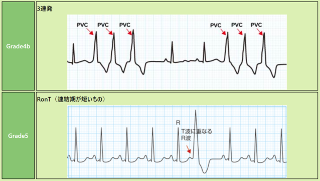 心電図の基礎から実践までをわかりやすく！ | ヘルスノート