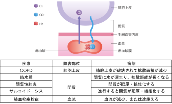 呼吸機能検査の見方と応用の仕方 | ヘルスノート